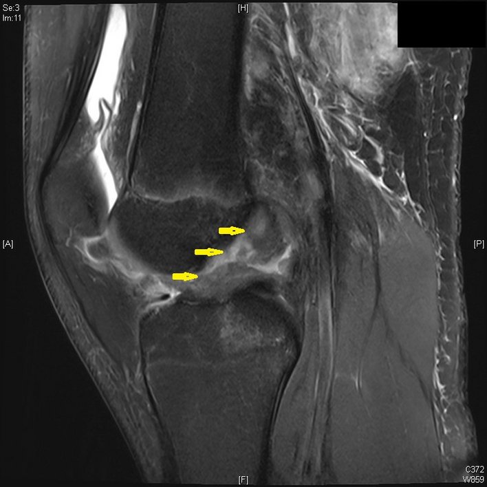 Knieschmerzen und -verletzungen | Universitätsklinik und Poliklinik für ...